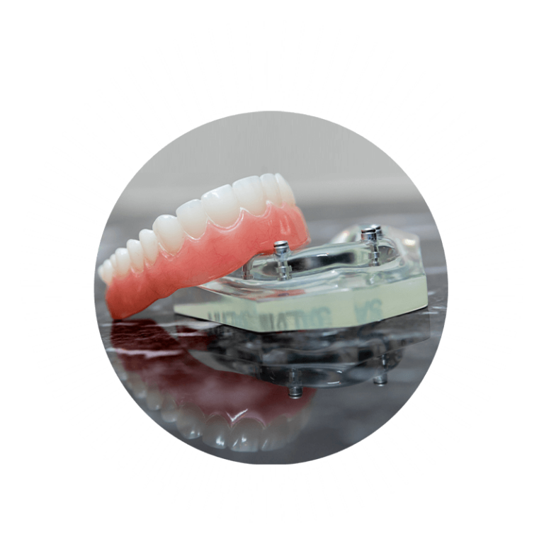Revive Denture & Implant Studio | Full Mouth Dental Implants | Flowood, MS